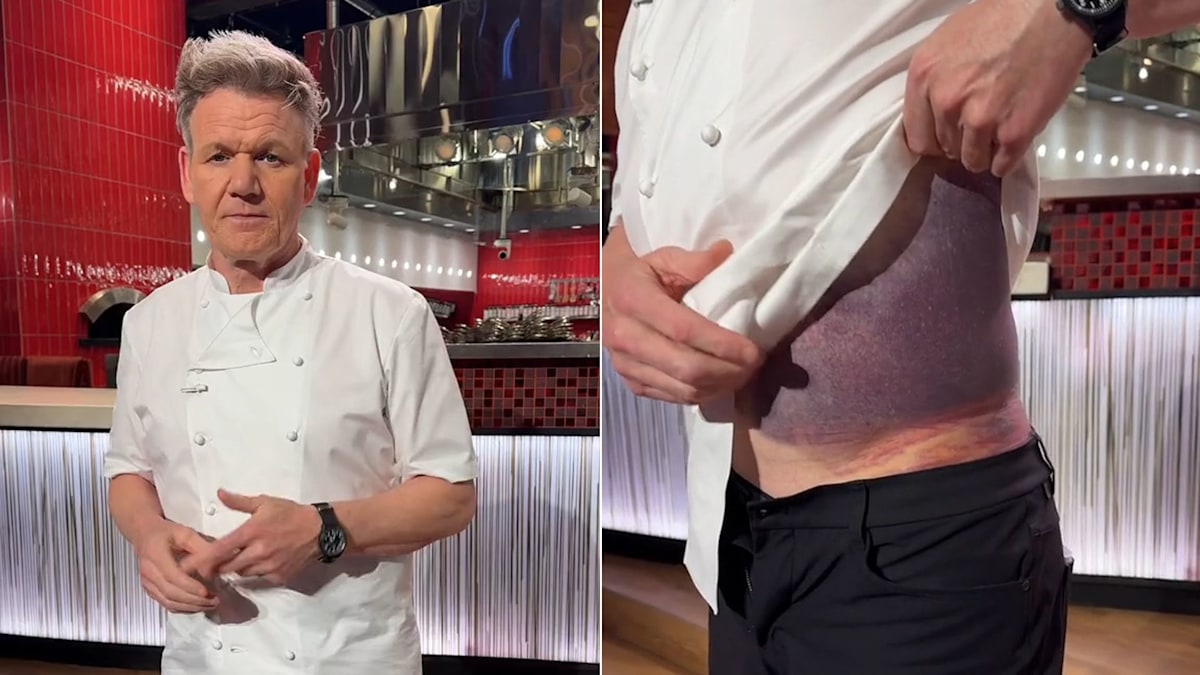 Gordon Ramsay Shakes And He Reveals He Is Lucky To Be Alive After