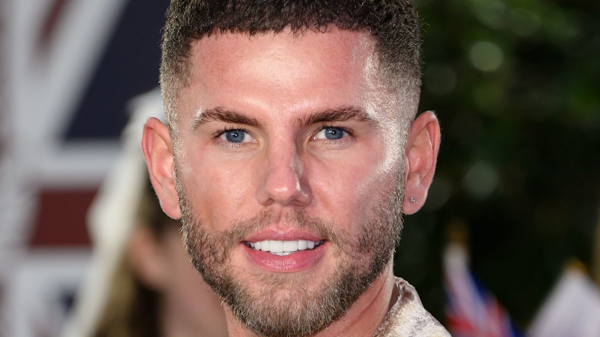 Dean McCullough's hair transplant he's 'buzzing' over - before and ...