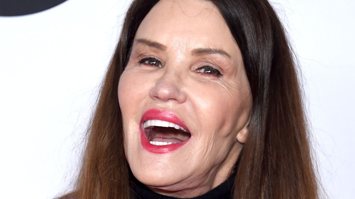 I'm a Celebrity star Janice Dickinson's teeth makeover: dramatic before ...