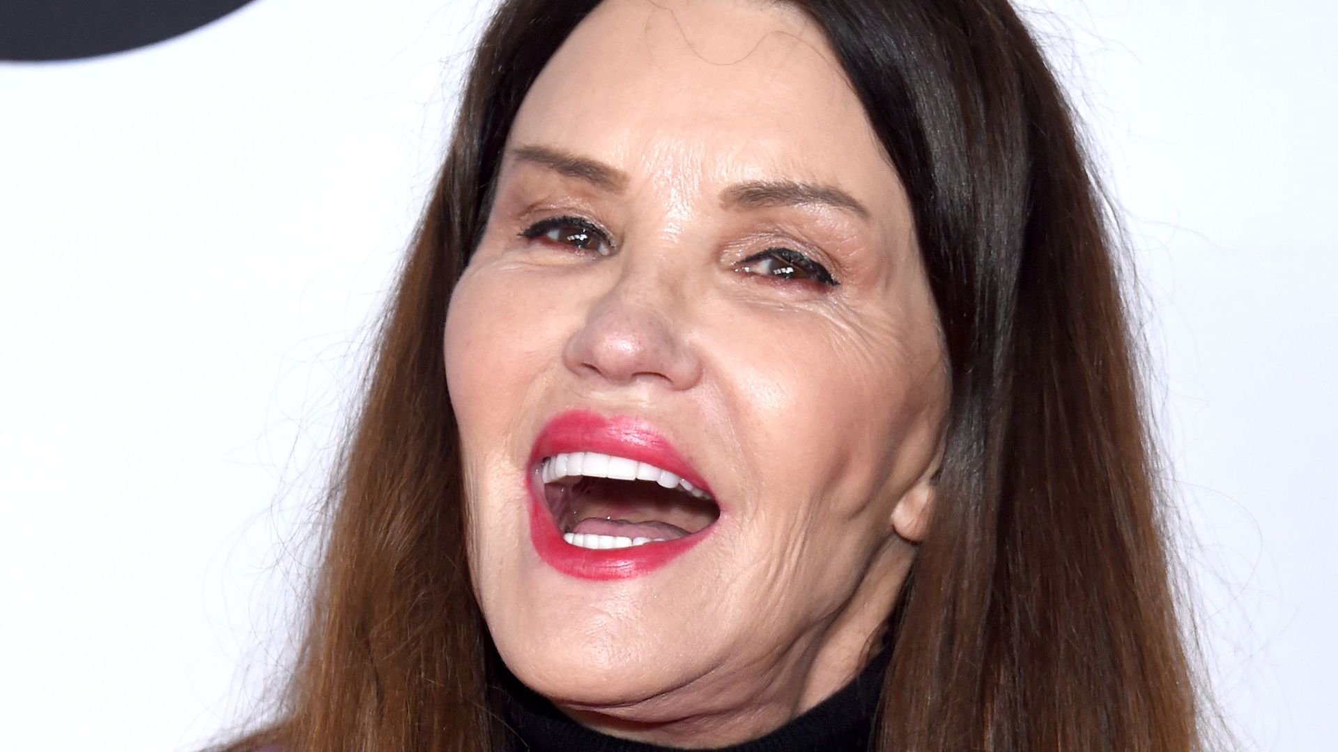 I'm a Celebrity star Janice Dickinson's teeth makeover: dramatic before ...