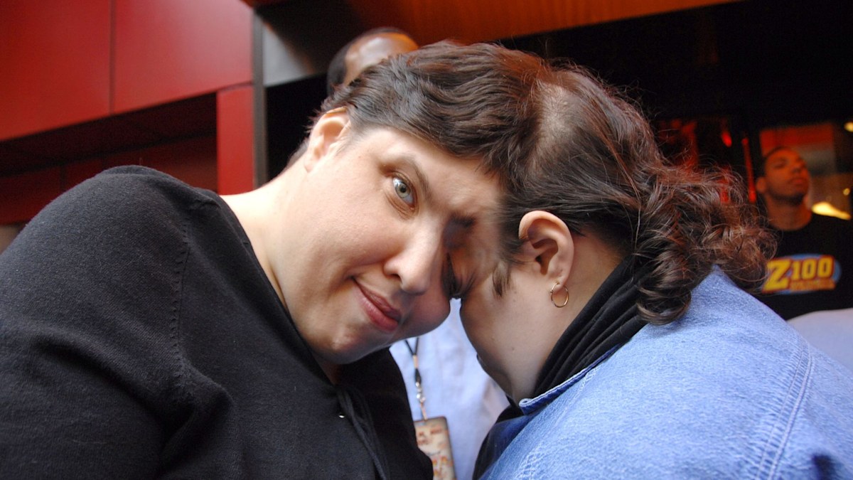 Lori and George Schappell, world's oldest conjoined twins, die aged 62 ...