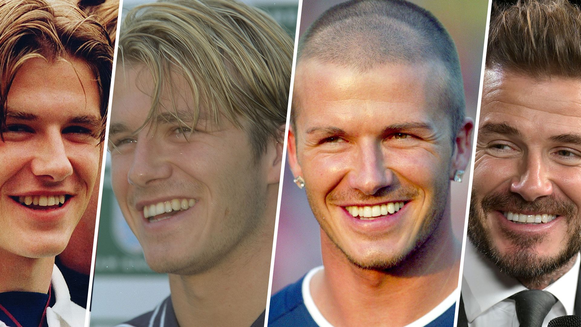 David Beckham's smile makeover: before and after photos | HELLO!