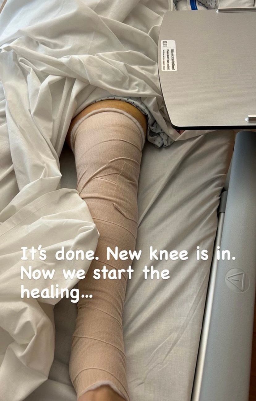 Dawn French flooded with support after sharing surgery update amid pain struggle | HELLO!