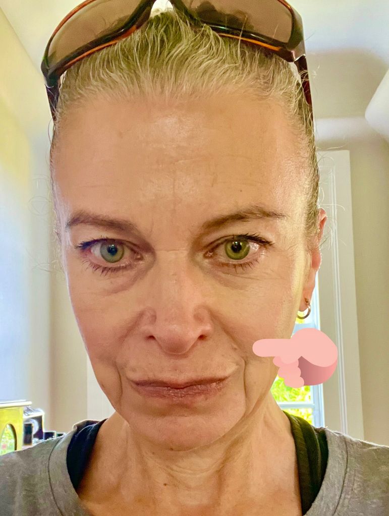 Ricky Gervais' partner Jane Fallon details 'worrying' skin cancer scare ...
