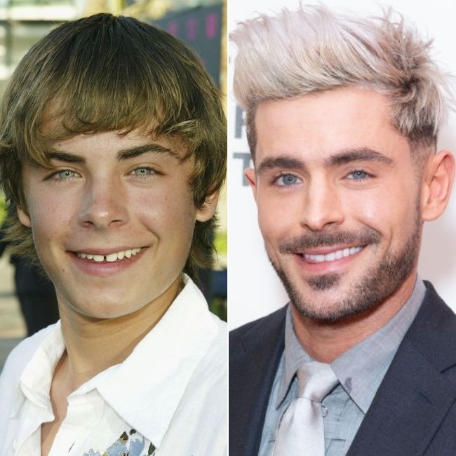 Celebrity teeth transformations: From Celine Dion to Victoria Beckham ...