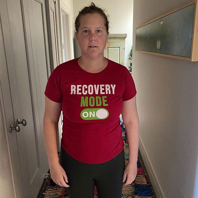 Amy Schumer shares video with doctor after finding tumor in appendix ...