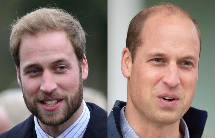 Royals with facial hair: Prince William's beard, Prince Harry, Mike ...