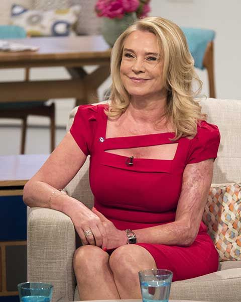 The Good Karma Hospital's Amanda Redman opens up about traumatic ...
