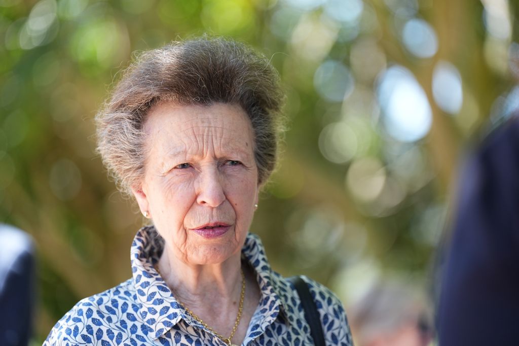 Princess Anne finally reveals details of accident that left her with no ...
