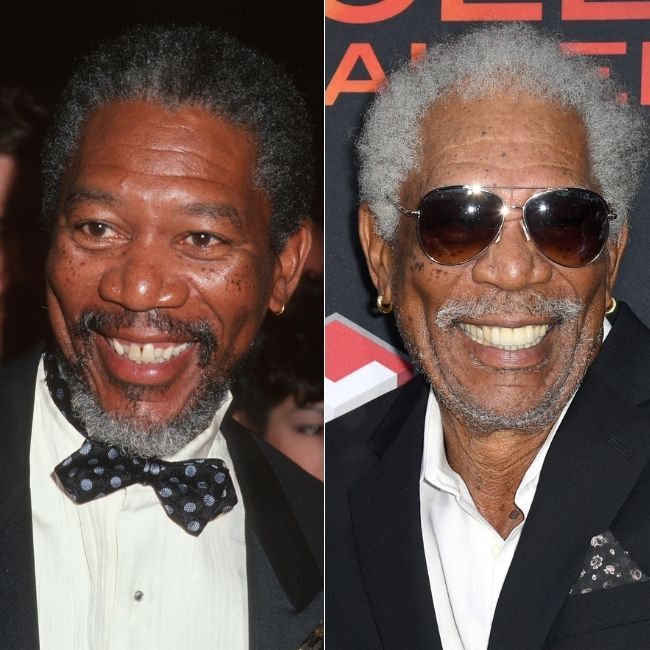 Celebrity teeth transformations: From Celine Dion to Victoria Beckham ...