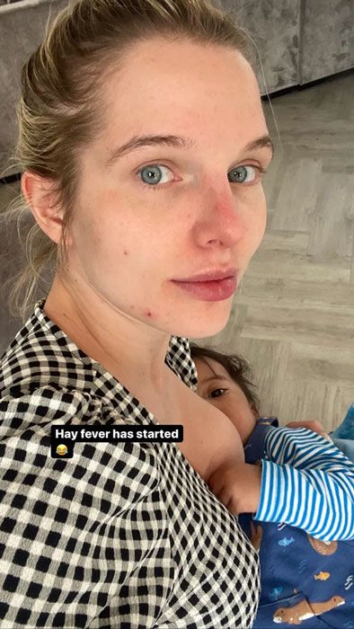 Helen Flanagan shares makeup-free selfie amid ongoing health woes | HELLO!