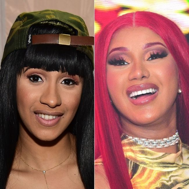 Celebrity teeth transformations: From Celine Dion to Victoria Beckham ...