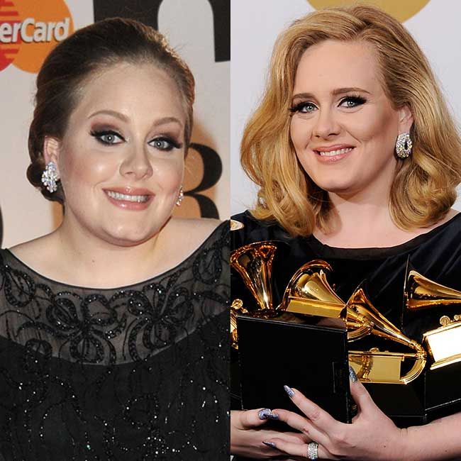 Drastic celebrity teeth transformations: Holly Willoughby, Victoria ...