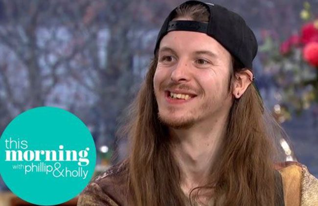 Emmerdale actor James Moore passionately speaks out on disability after ...