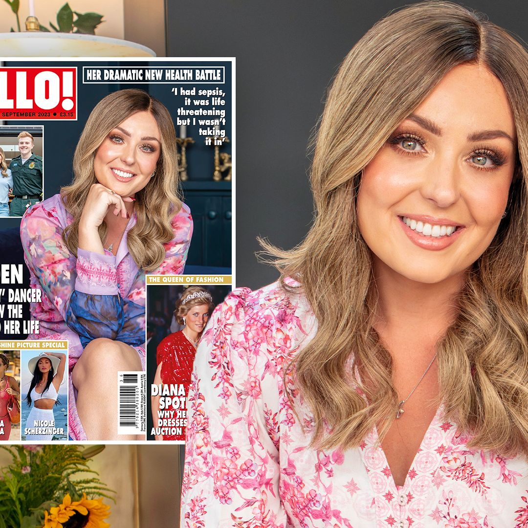 Amy Dowden reveals why she doesn't want to shave her head despite hair loss | HELLO!