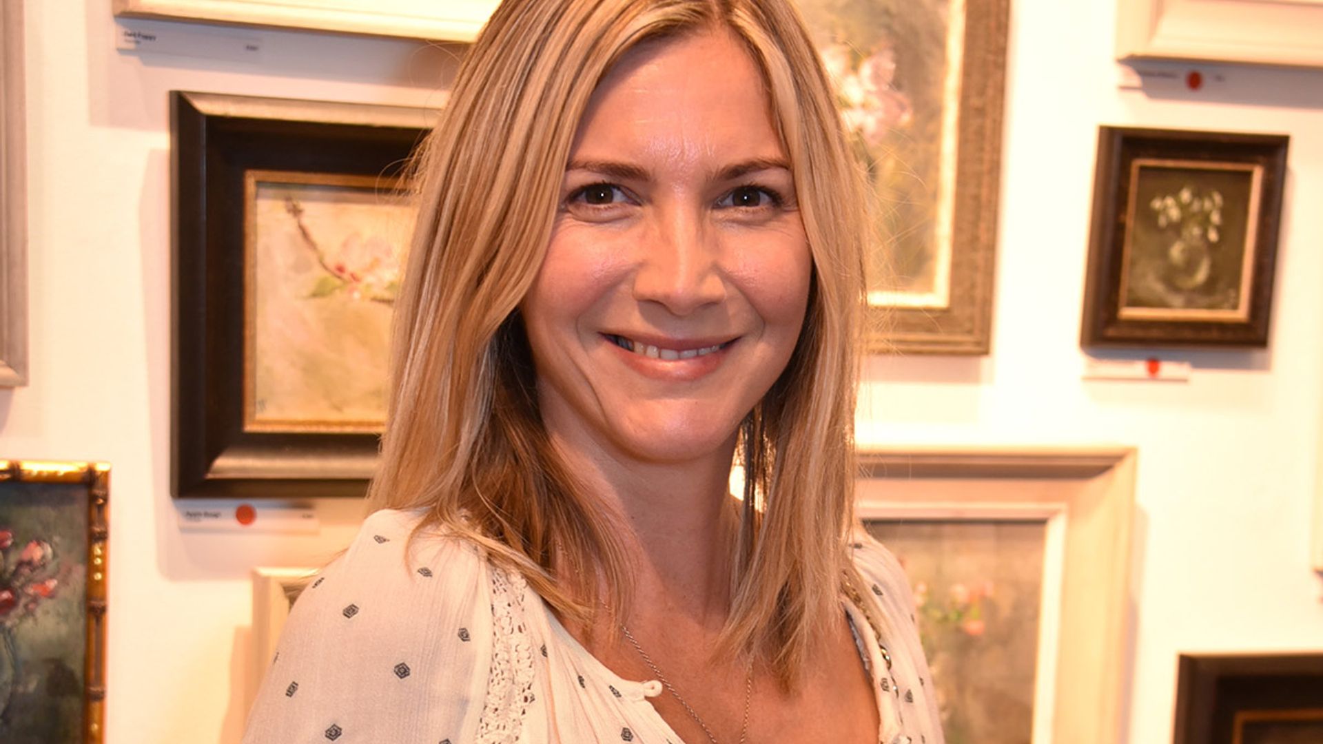Lisa Faulkner reveals she will need x-ray after health scare | HELLO!
