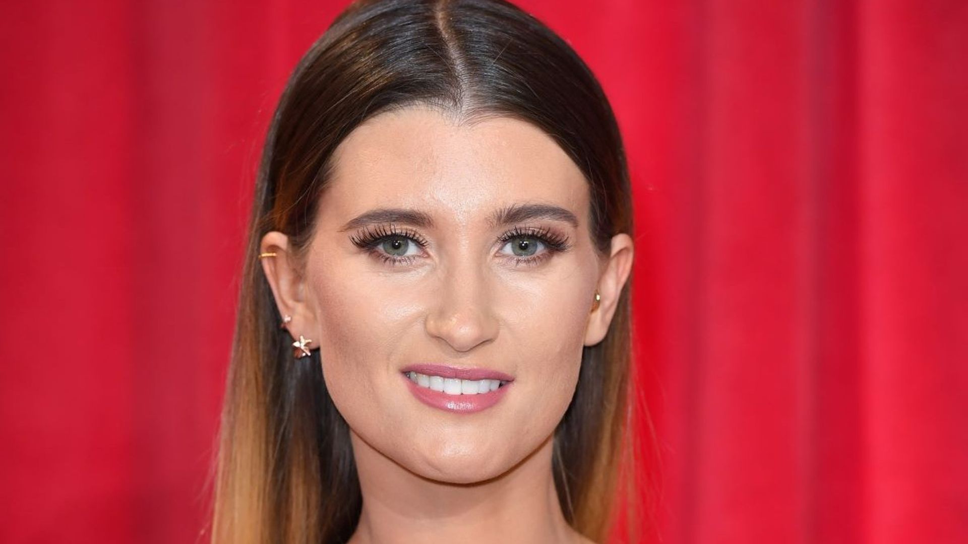 Charley Webb reveals why she feels 'lucky' following painful car ...