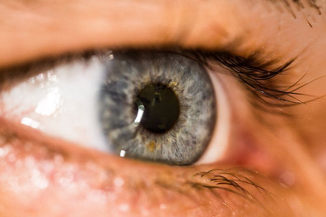 Considering laser eye surgery? Everything you need to know | HELLO!