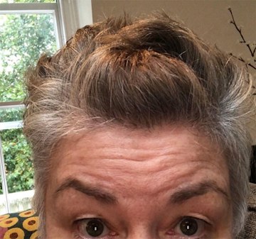 Dawn French stuns fans with total hair transformation! | HELLO!
