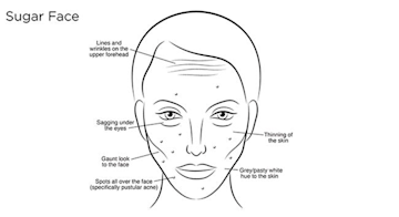 How your diet affects your face | HELLO!